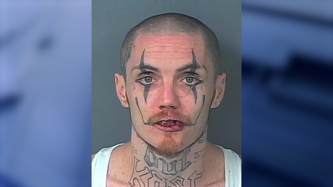 Florida Man Cuts Off Ankle Monitor Rearrested One Day After Release