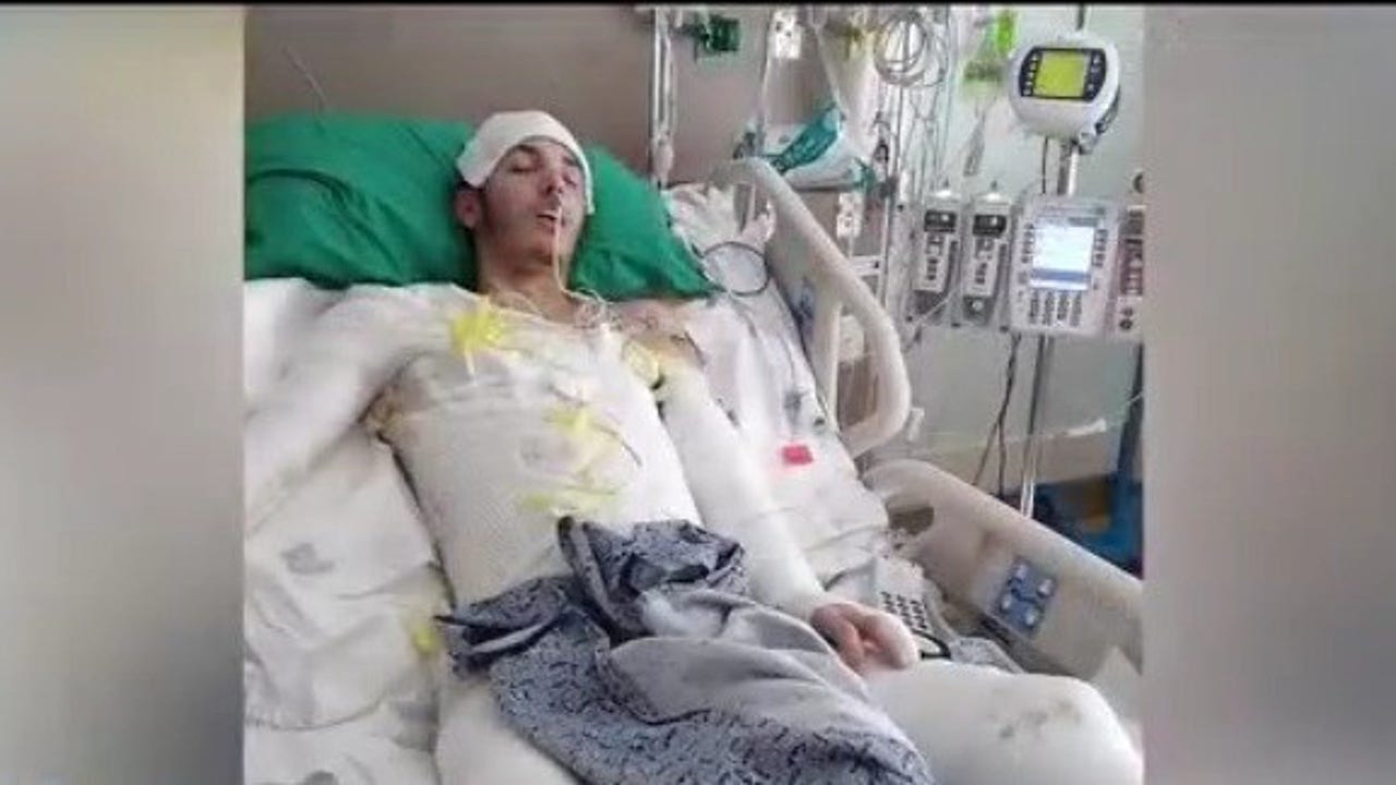 Man set on fire by Taser sues Florida sheriff's office, deputies over ...