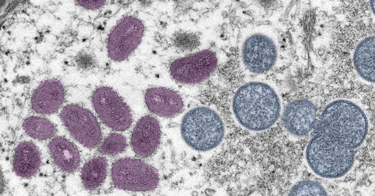 Dallas County hosts pop-up monkeypox vaccine clinic | FOX 4 Dallas-Fort ...