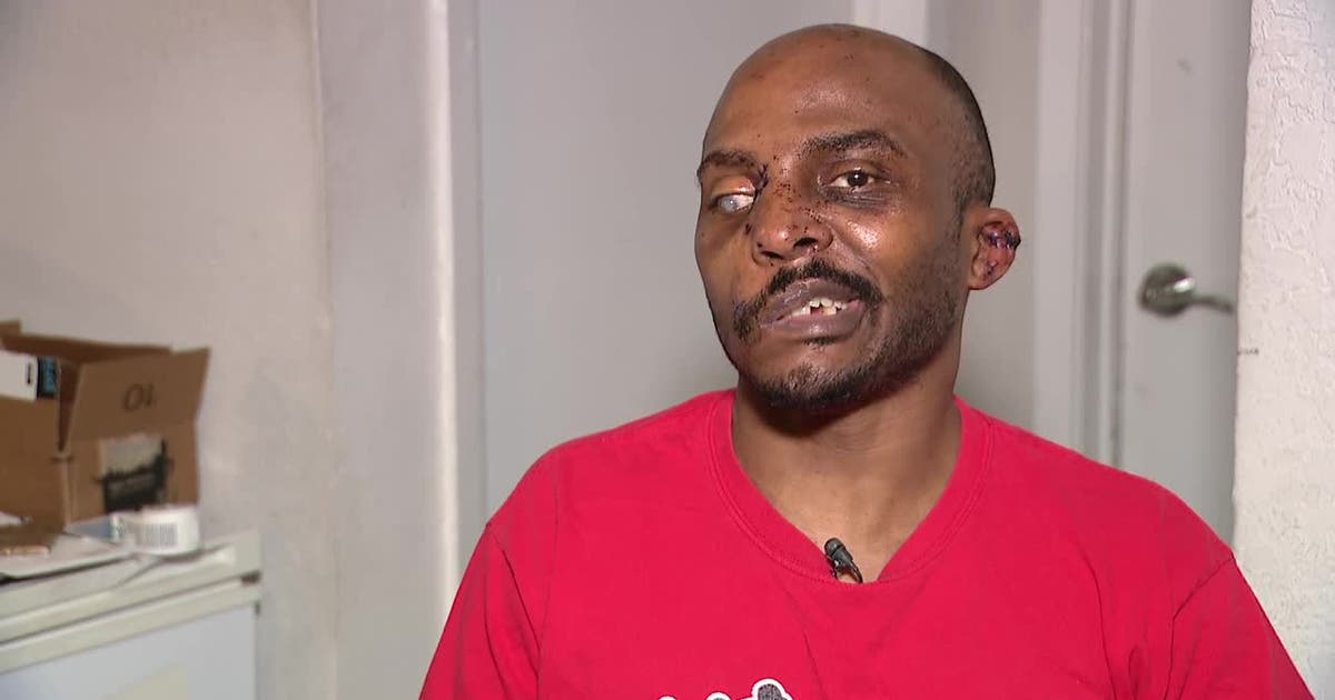 5 pit bulls quarantined after attacking Arlington man | FOX 4 Dallas ...