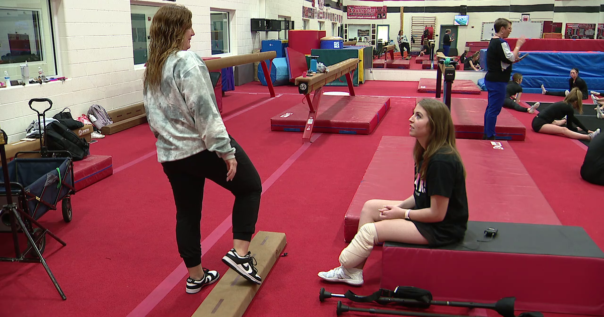 Rockwall cheerleader with amputated leg determined to cheer again | FOX ...