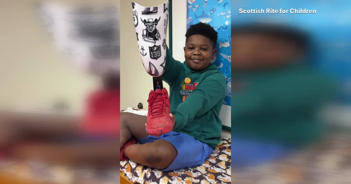 Young fan’s new prosthetic leg features Dak Prescott’s tattoos | FOX 4 ...