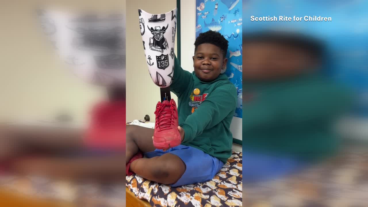 Young fan’s new prosthetic leg features Dak Prescott’s tattoos | FOX 4 ...