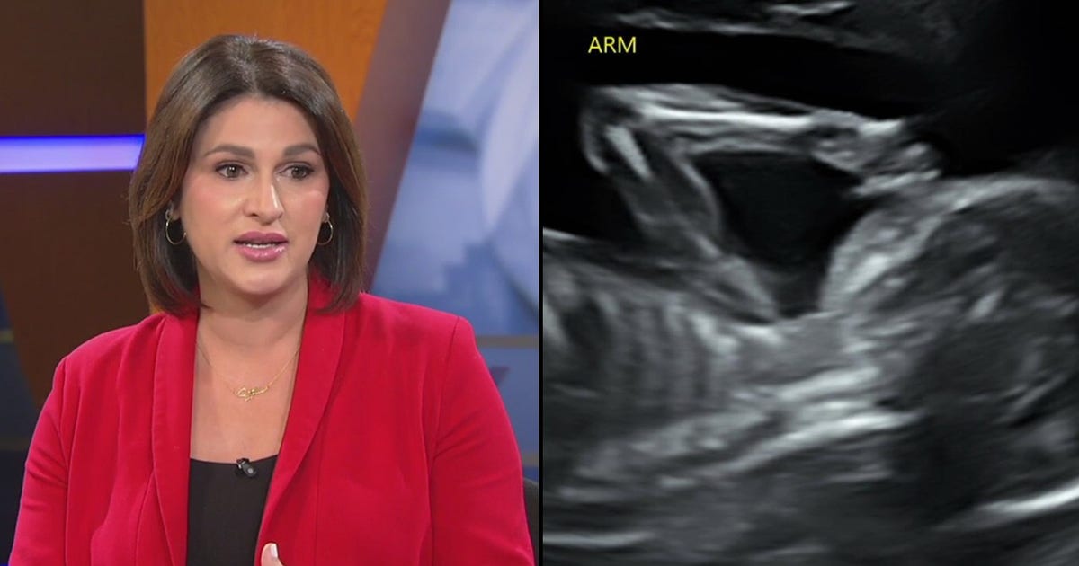 Shannon Murray shares update on unborn daughter's health condition ...
