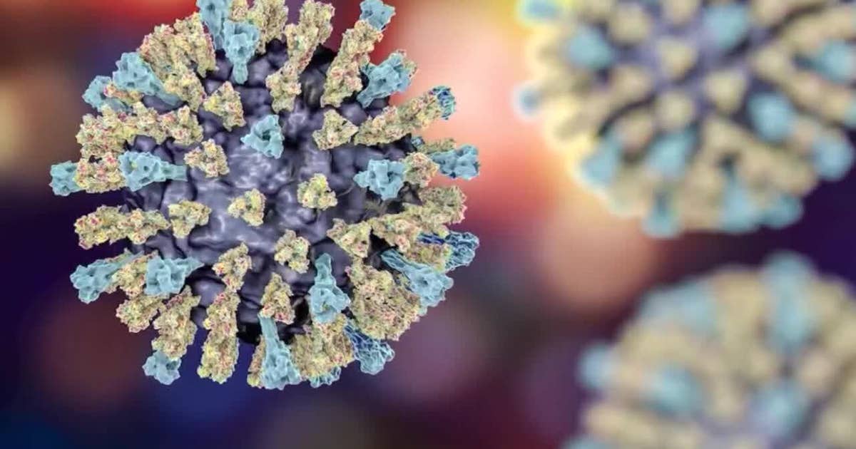 Texas measles outbreak 2025: State reports 20 new cases as total nears ...