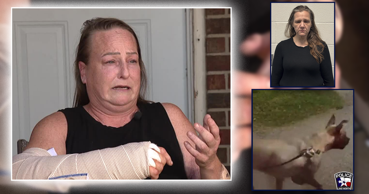Dog Attack: Owner, boyfriend arrested after pit bull mauling ...