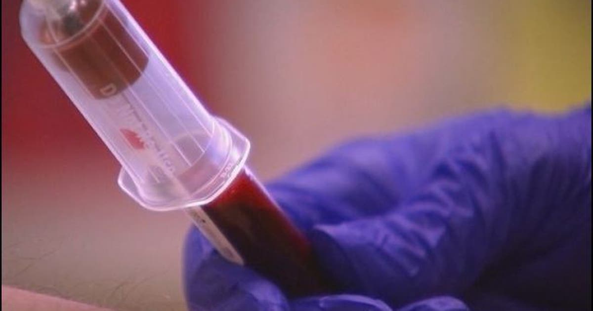 Scientists close in on blood test for Alzheimer's | FOX 5 Atlanta