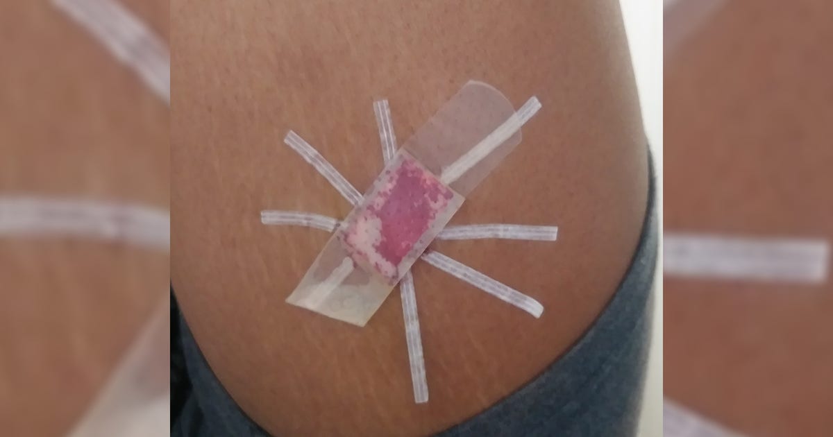 Teen given botched birth control implant at school without parents ...