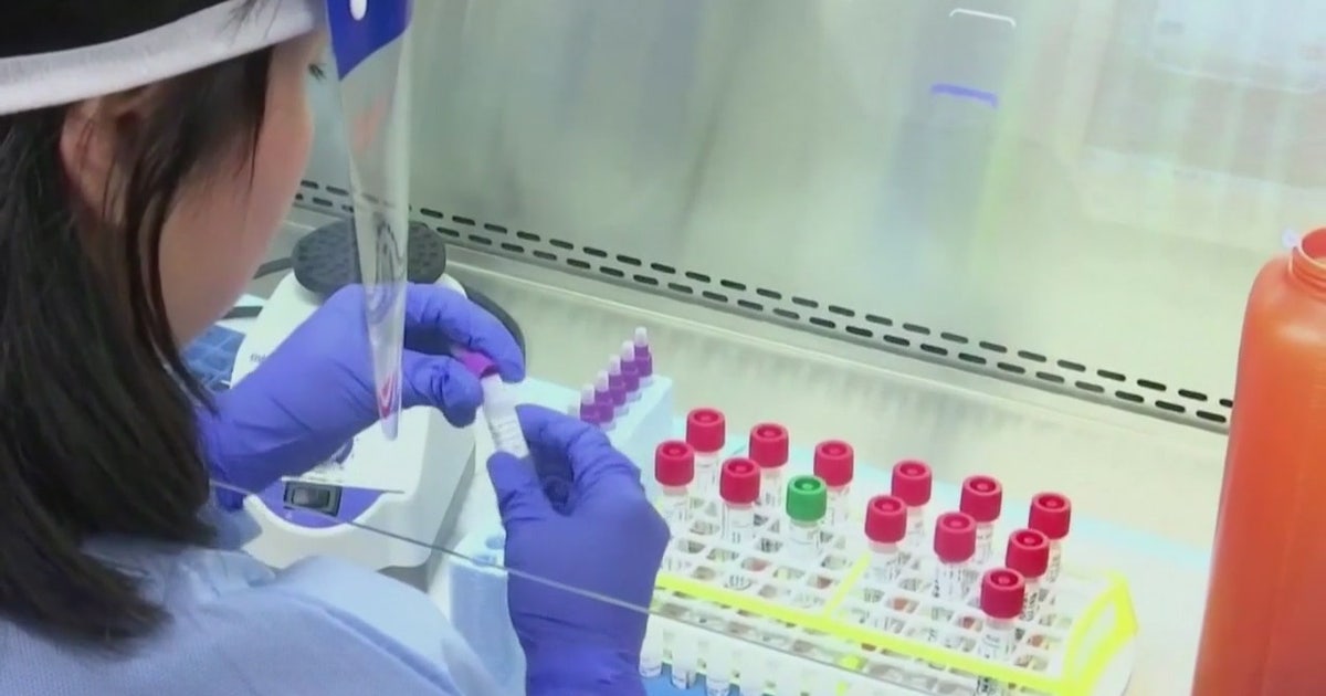 Long COVID could be aging organs faster by 3-4 years, research shows ...