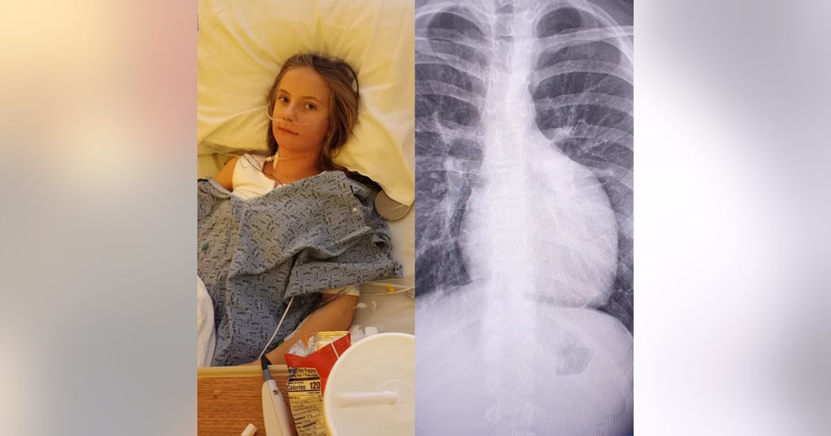 Georgia girl, 12, has already survived two major health challenges ...