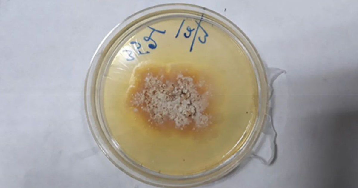Dangerous plant fungus infects man in first-known global case, doctors ...