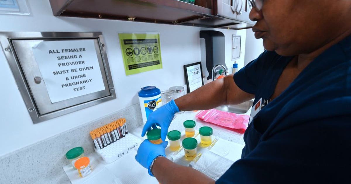 Houston, Harris County experiencing syphilis outbreak, 128% increase in ...