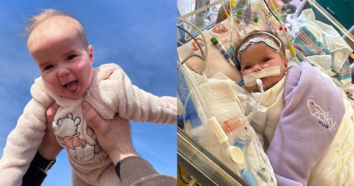 Infant undergoes successful open heart surgery at Children's Healthcare ...
