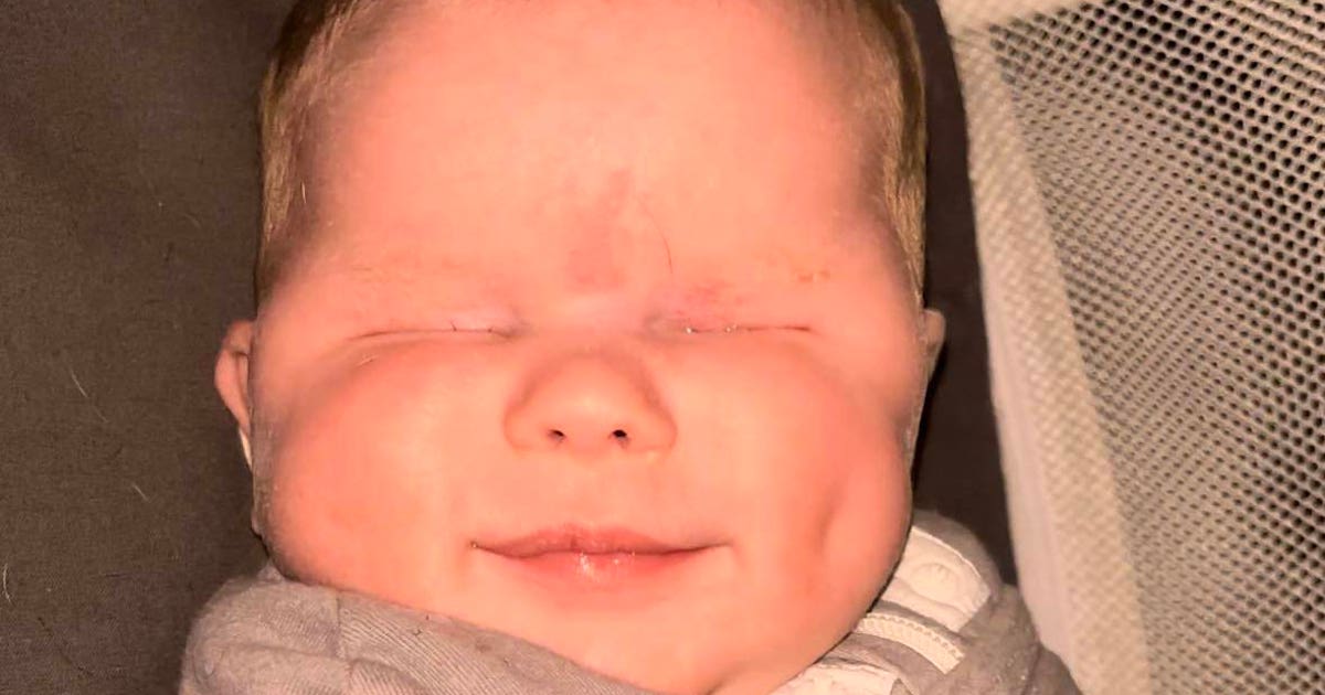 Baby born without eyes, diagnosed with rare genetic disorder | FOX 5 ...