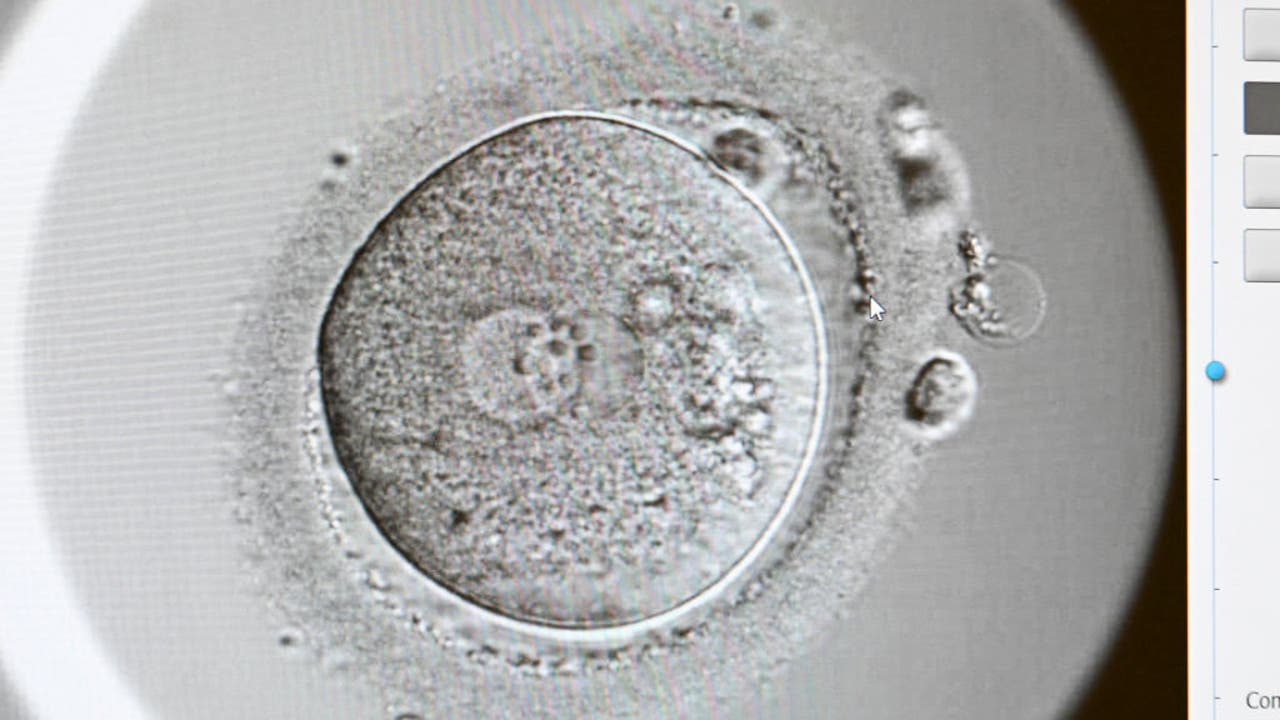 Alabama Supreme Court IVF Ruling: What frozen embryo ruling means for ... Alabama Supreme Court IVF Ruling: What frozen embryo ruling means for ...