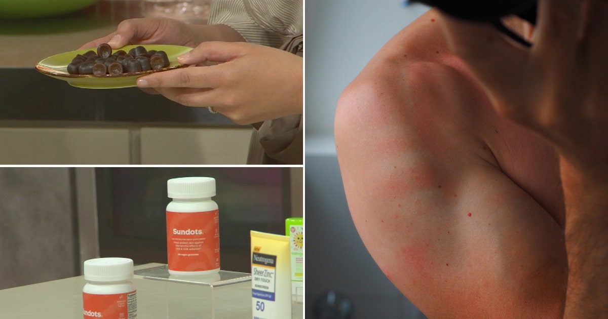 Can a vitamin help prevent you from getting sunburn? | FOX 5 DC