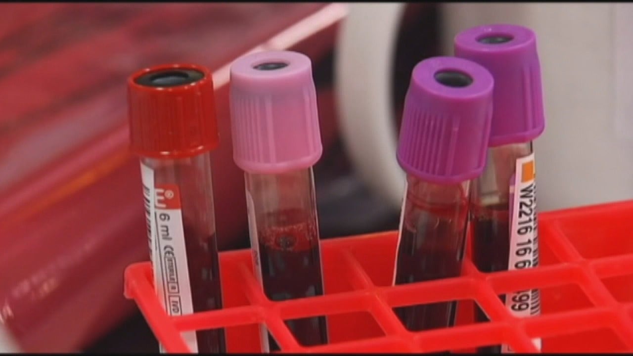 Researchers create possible blood test to detect breast cancer | FOX 5 DC