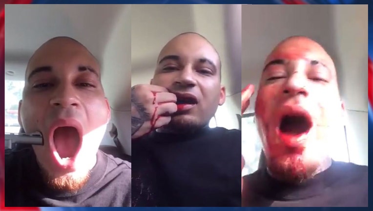 Rapper Shoots Himself In The Face For Music Video