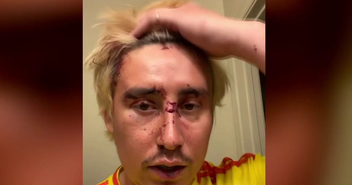 Man needs staples in head after attack on Metro train on Cinco de Mayo ...