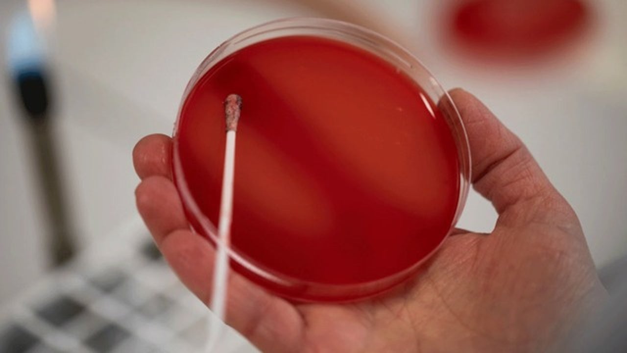 Scientists targeting 'zombie cells' to fight aging, disease | FOX 5 New ...