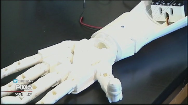 Student designs prosthetic arm | FOX 5 New York