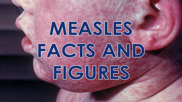 Measles and the MMR vaccine: facts and figures | FOX 5 New York