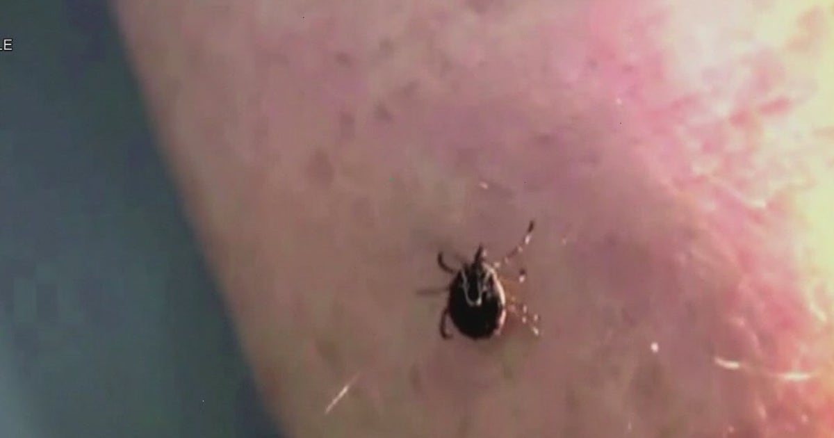 Tick populations on the rise | FOX 5 New York