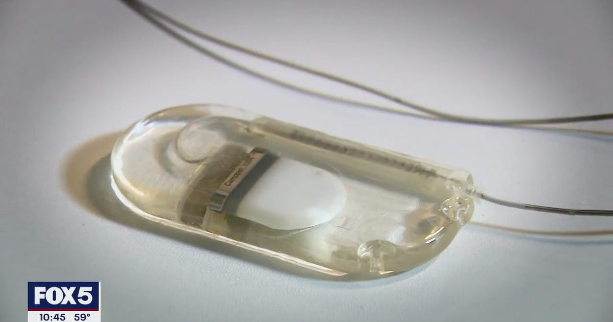 Brain chips are being implanted through the jugular vein | FOX 5 New York