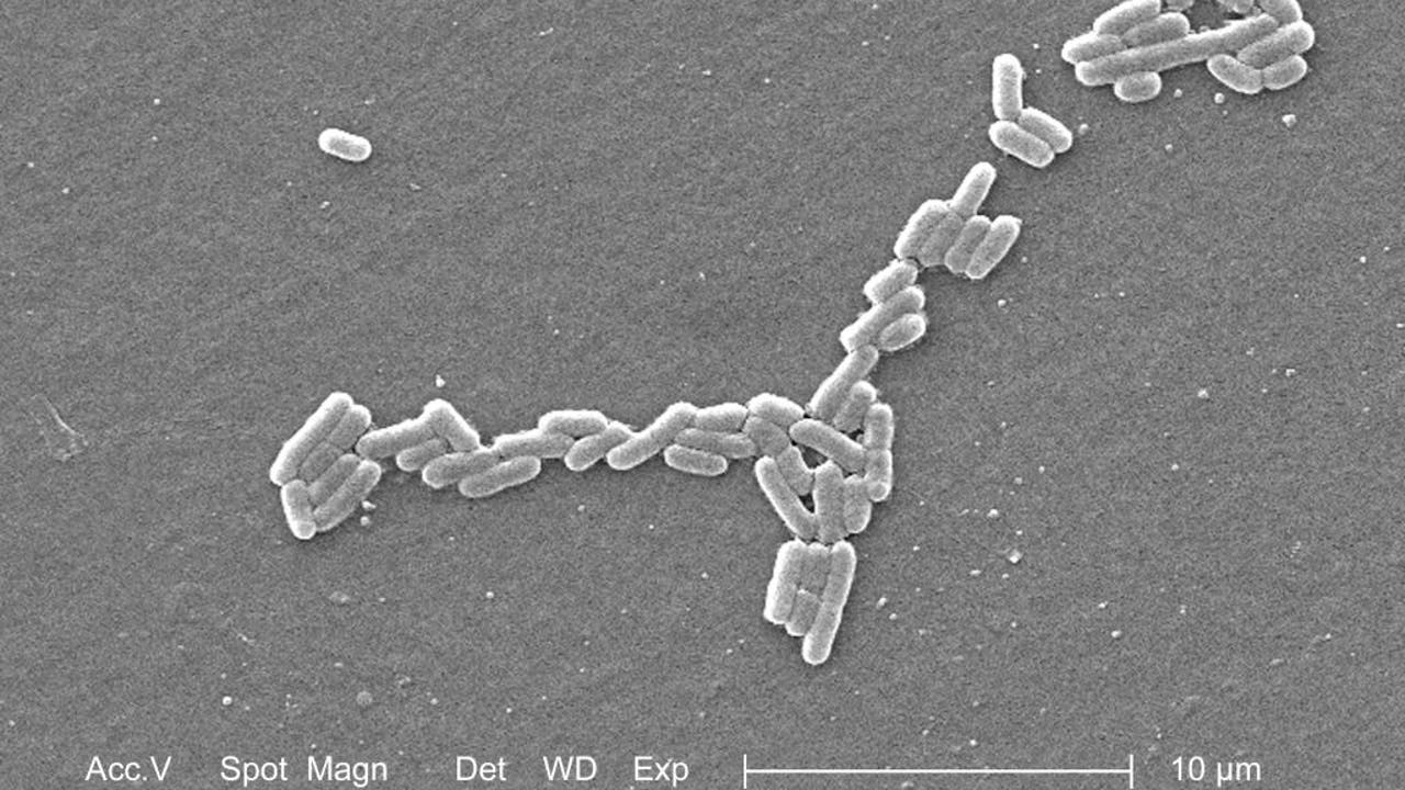 Drug Resistant Stomach Bug Shigella Spreading Nationwide Fox 5 New York