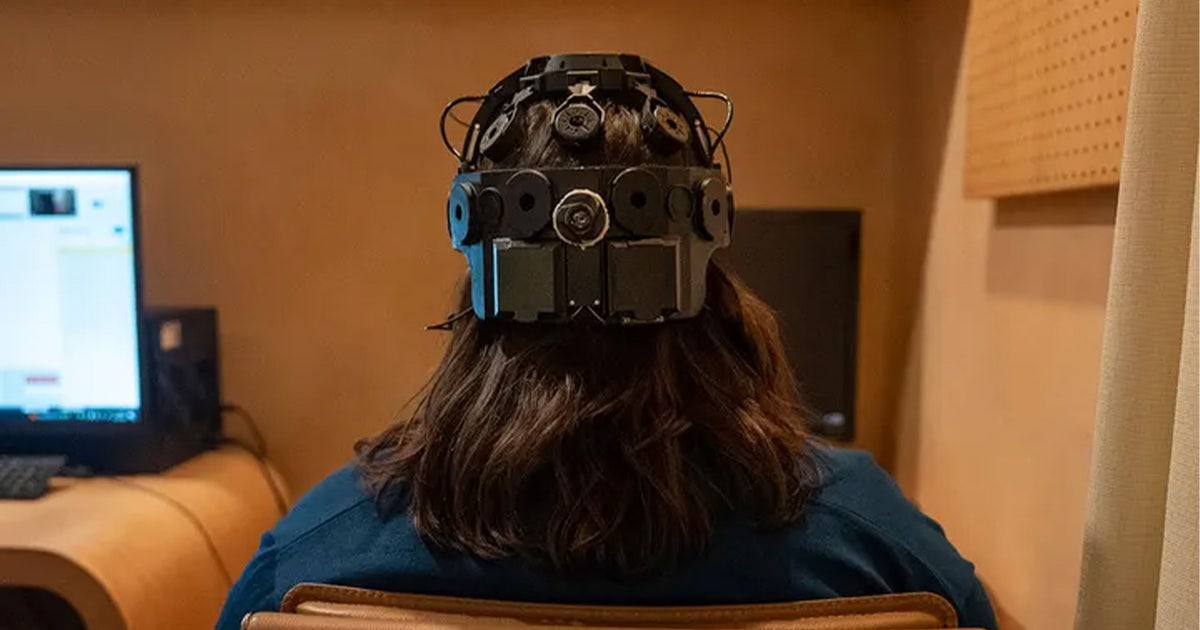 A pacemaker for the brain helped a New York woman with crippling ...