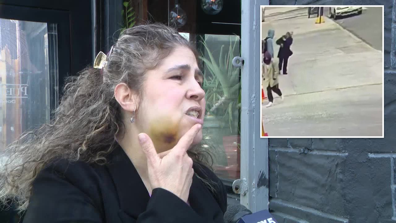 Why Was An Nyc Sucker Punch Suspect Released Without Bail Fox 5 New York