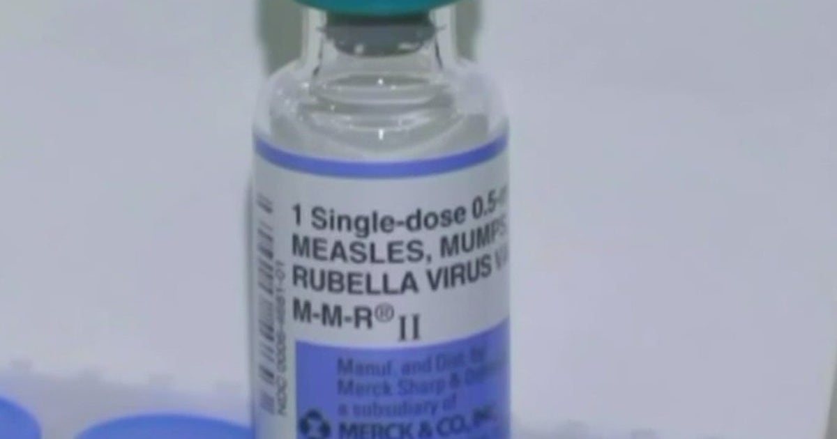 Measles case in Passaic County, New Jersey: What to know | FOX 5 New York