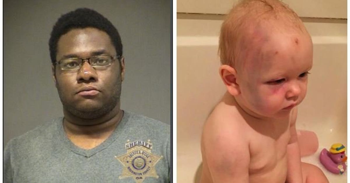 Babysitter charged after dad posts heartbreaking photos of one-year-old ...
