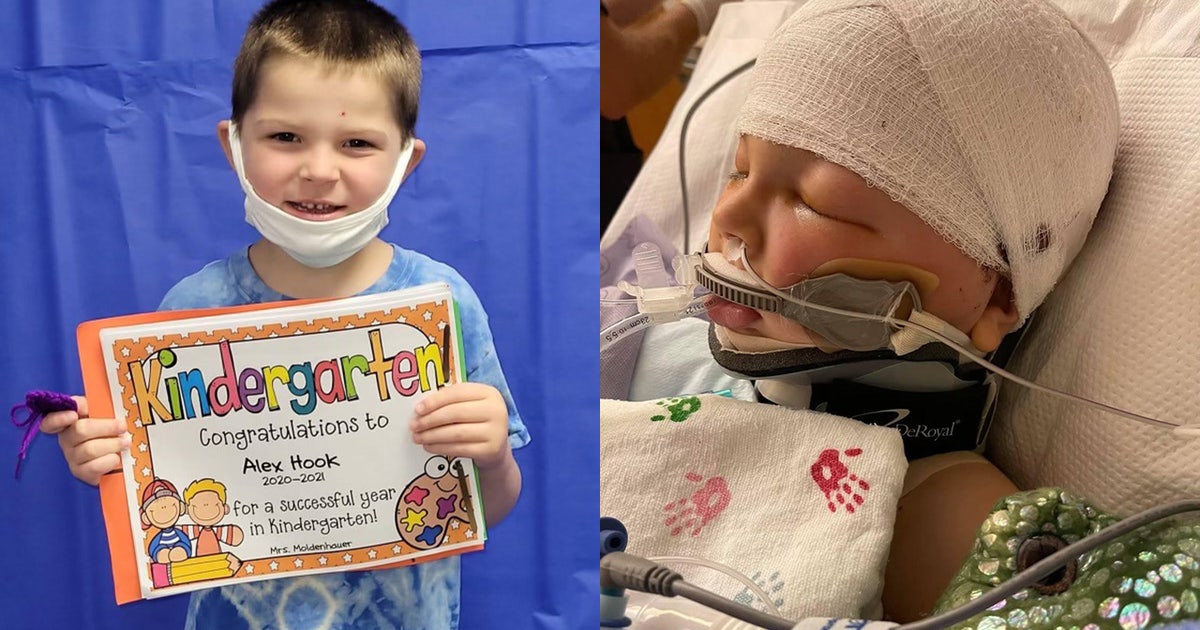 Boy struck by projectile on playground in medically-induced coma | FOX6 ...