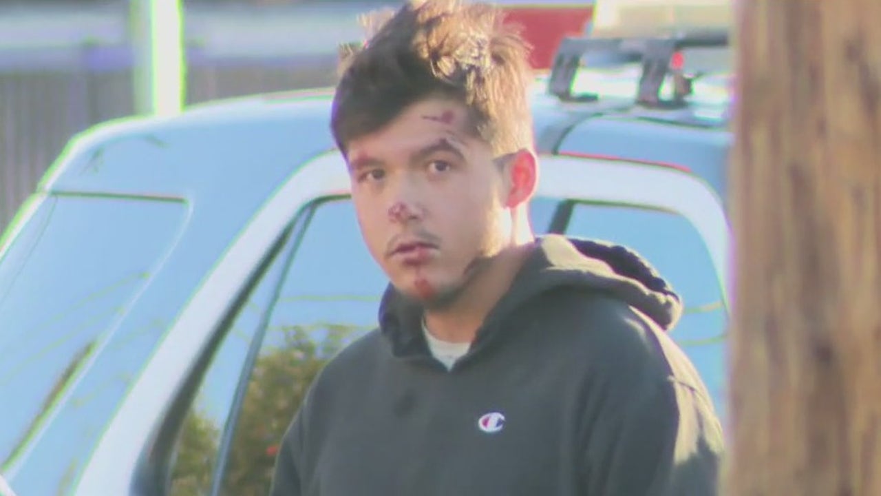 California Driver Accused Of Hitting Law Enforcement Recruits Released