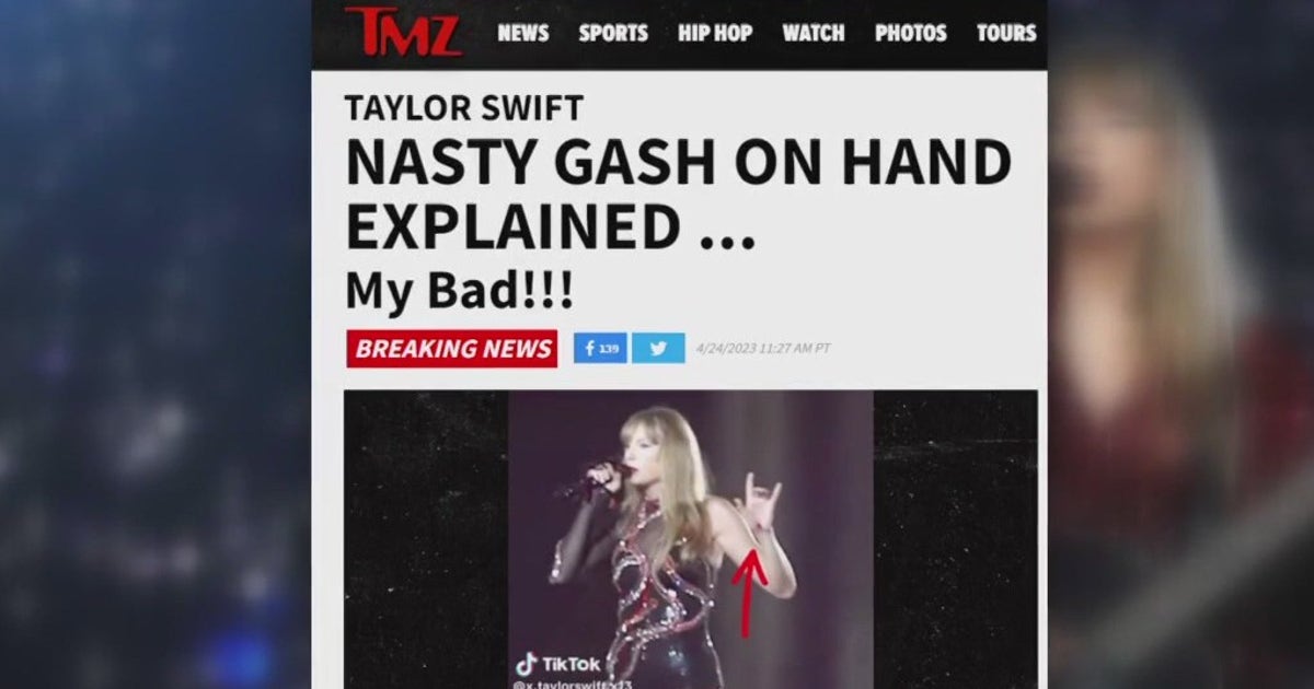 Taylor Swift's injury goes viral | FOX6 Milwaukee