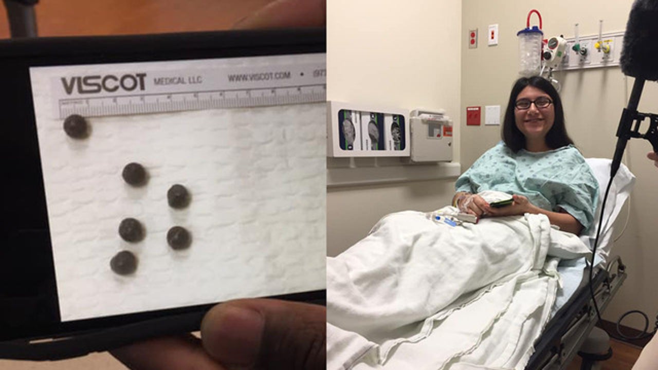 Santa Fe H.S. shooting survivor Sarah Salazar has six pellets removed ...