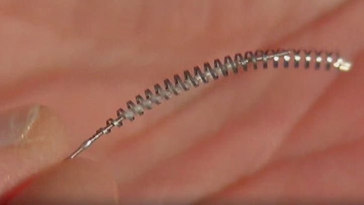 FDA plans to review Essure birth control | FOX 7 Austin