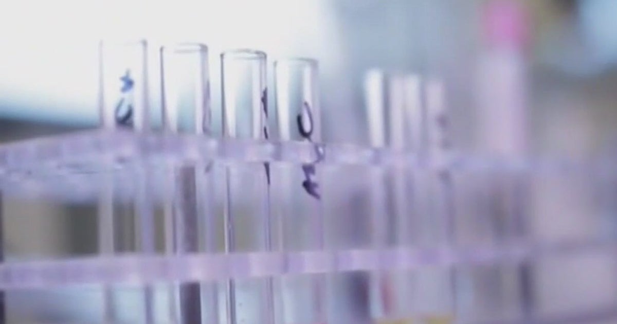 Austin Public Health launches campaign amid rising HIV diagnoses | FOX ...