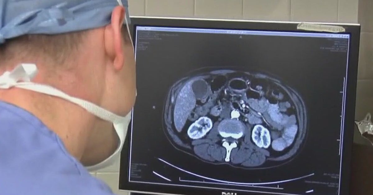 Austin doctor speaks on prostate cancer awareness | FOX 7 Austin