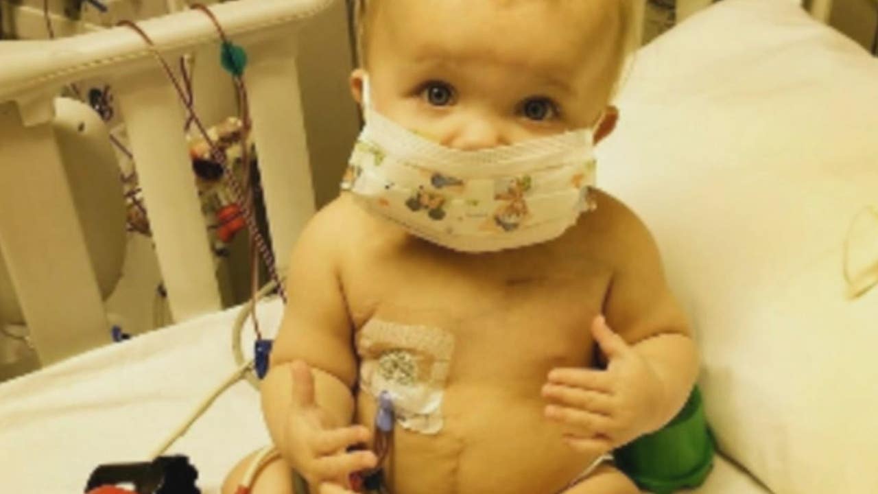 100 percent success rate for baby kidney transplants at U of M | FOX 9 ...