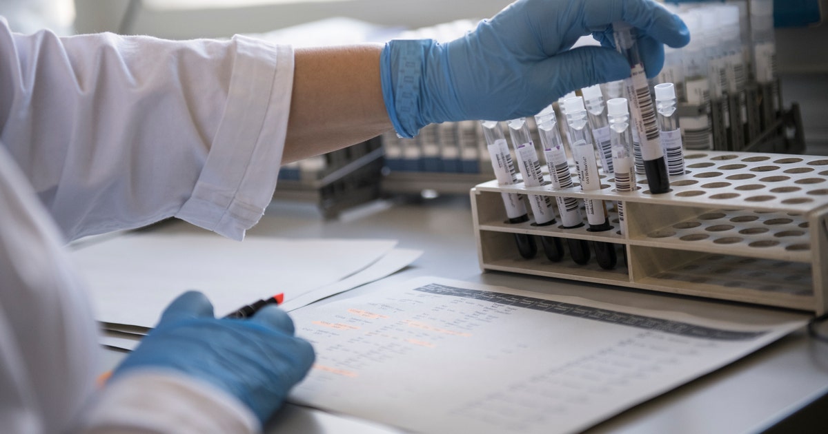 COVID-19 in Minnesota: Test result reporting delays from private lab ...