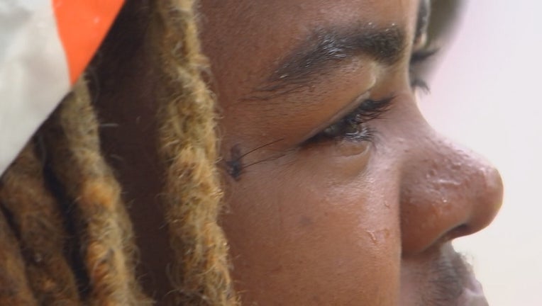 Man Grazed By Bullet In Minneapolis Shooting Recounts Moments As Shots