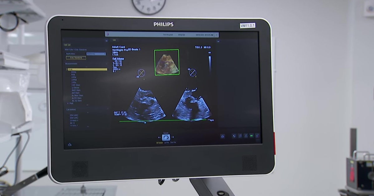 Gov. Walz touts Philips expansion in MN: 'That's how you bring ...