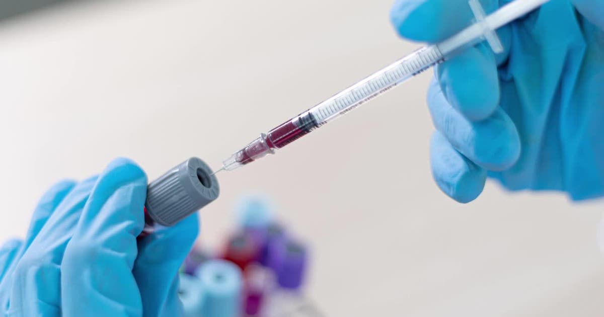 New FDA-approved Alzheimer’s blood test coming to Mayo Clinic | FOX 9 ...