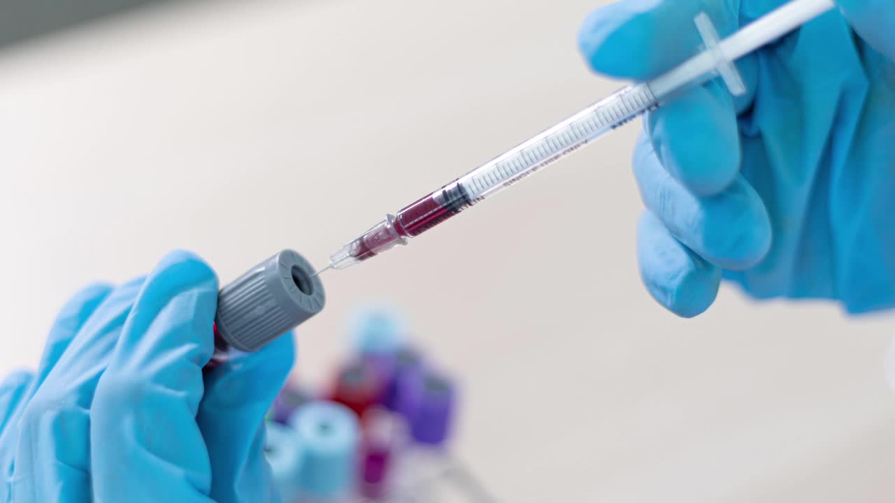 New FDA-approved Alzheimer’s blood test coming to Mayo Clinic | FOX 9 ...