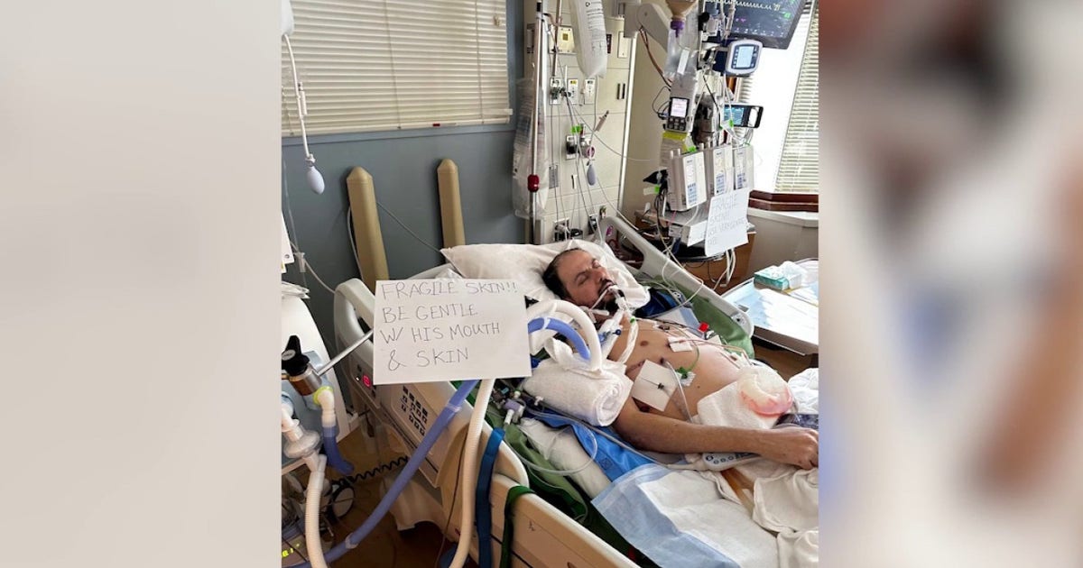 Woodbury man with rare skin disorder released from ICE custody, brother ...