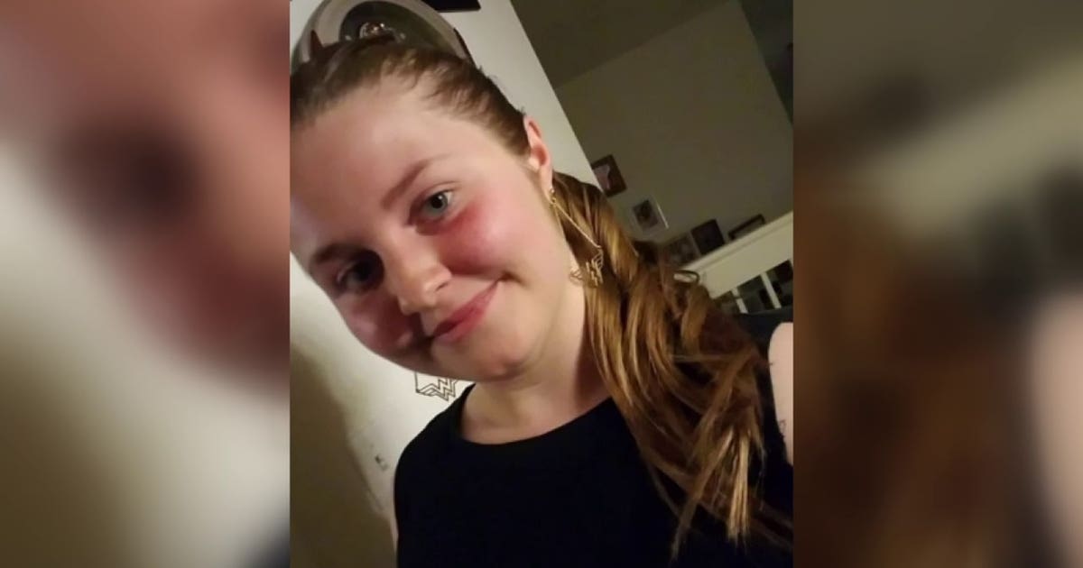 Nevada teen suffers seizures, extremely rare brain clots after Johnson ...