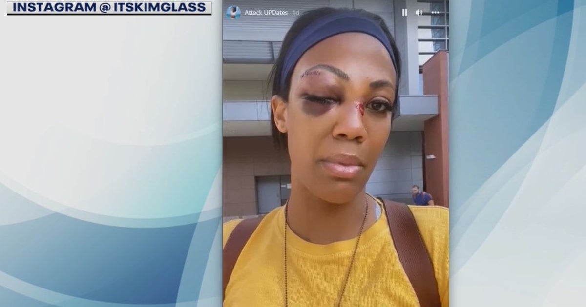 US Olympian Kim Glass allegedly attacked by homeless man in DTLA | FOX ...