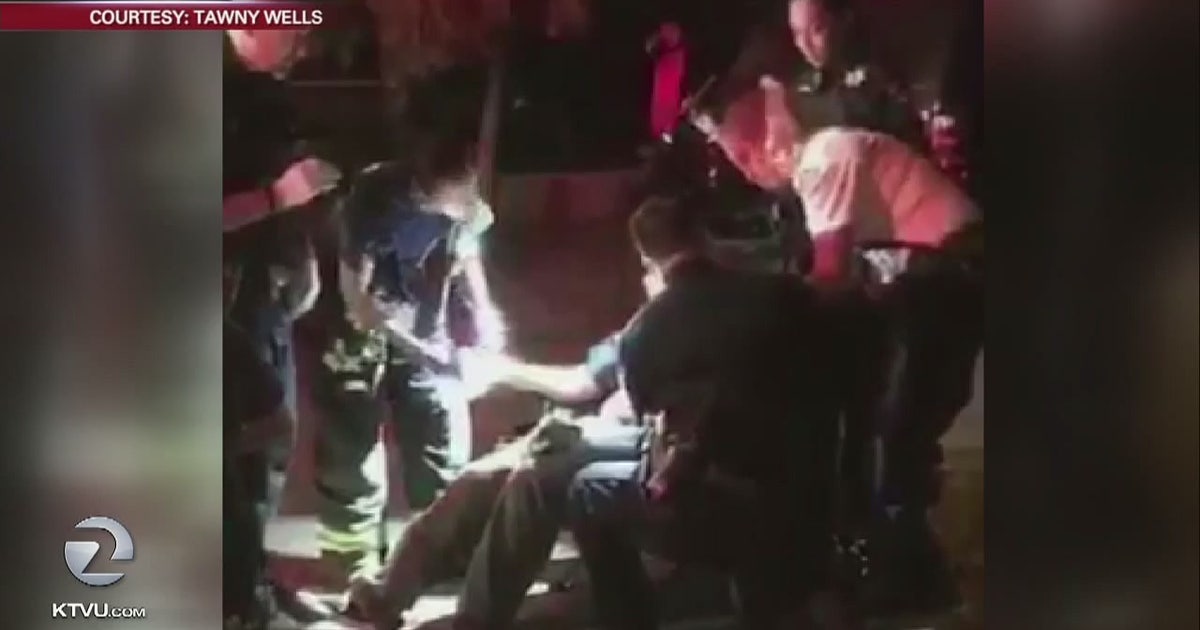 Teenager loses fingers in fireworks explosion | KTVU FOX 2